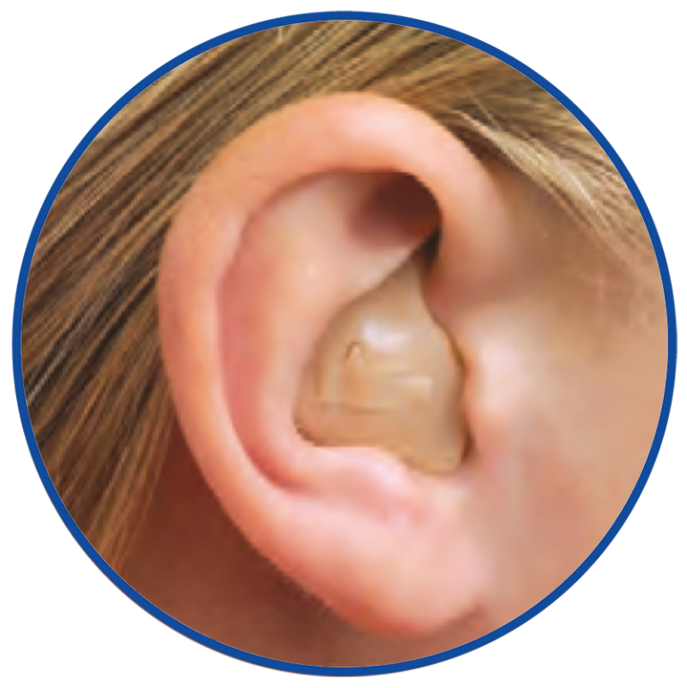 Full_shell_in_the_ear - Expert Hearing